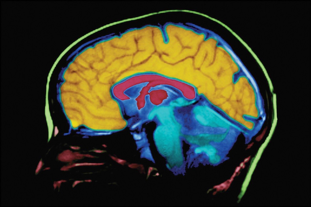 Improved MALDI Imaging Quality and Speed Using the MALDI SYNAPT G2-Si ...