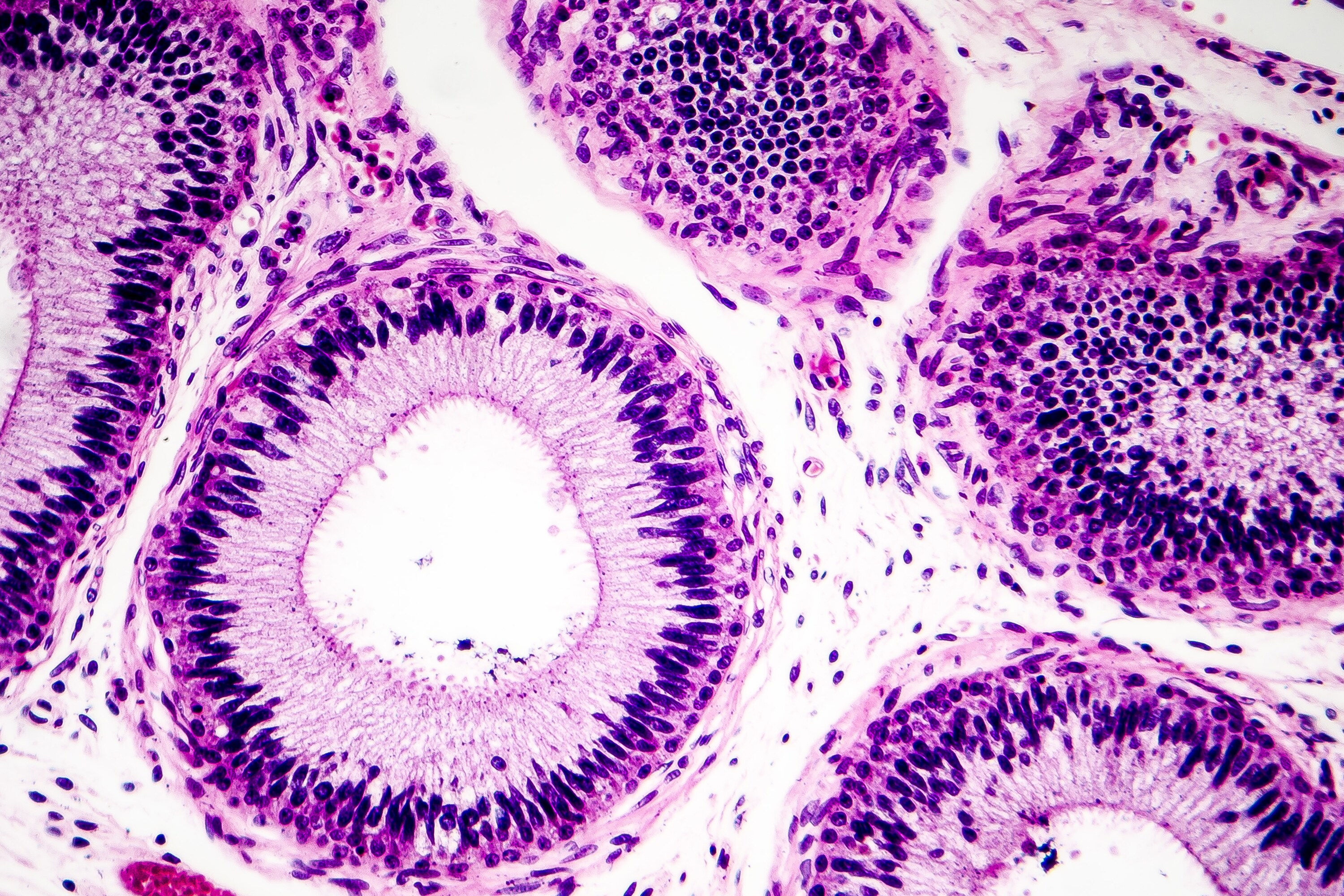 Generation of Multiple Images from a Single Tissue Section with Dual ...
