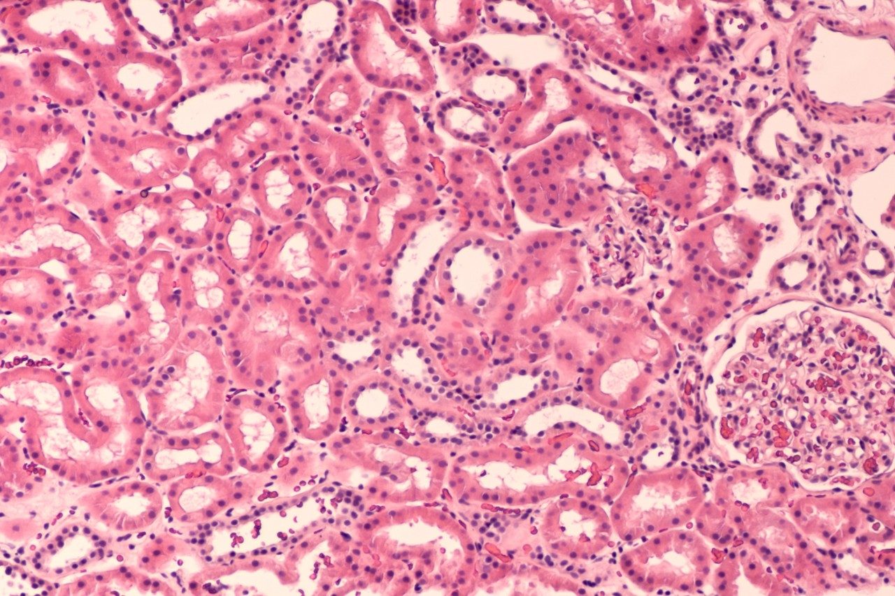 Direct Tissue Imaging and Characterization of Phospholipids Using MALDI ...