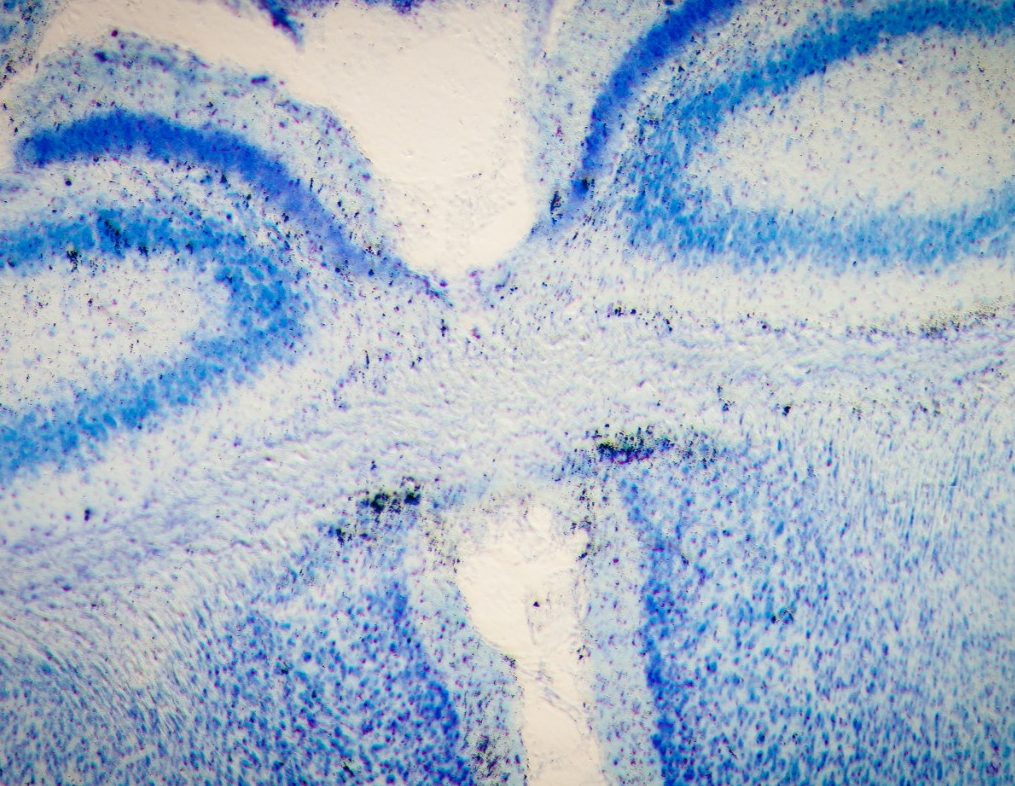 MALDI Imaging with Enhanced Spatial Resolution and Speed with the MALDI ...