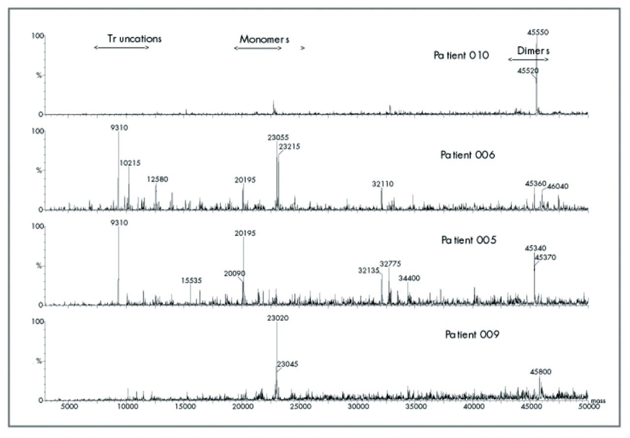 Structural Analysis of the Amyloidogenic Immunoglobulin Light Chains ...