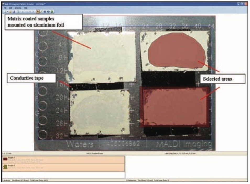 Advances in MALDI Imaging Mass Spectrometry - Adding a New Dimension of ...
