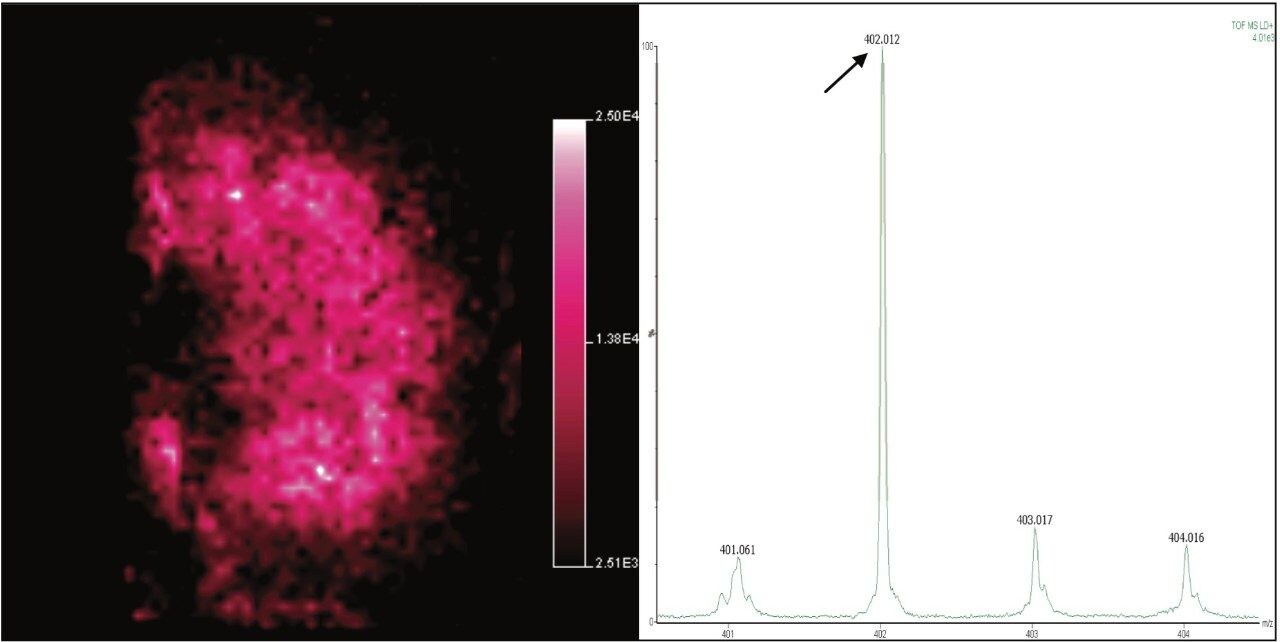 Advances in MALDI Imaging Mass Spectrometry - Adding a New Dimension of ...
