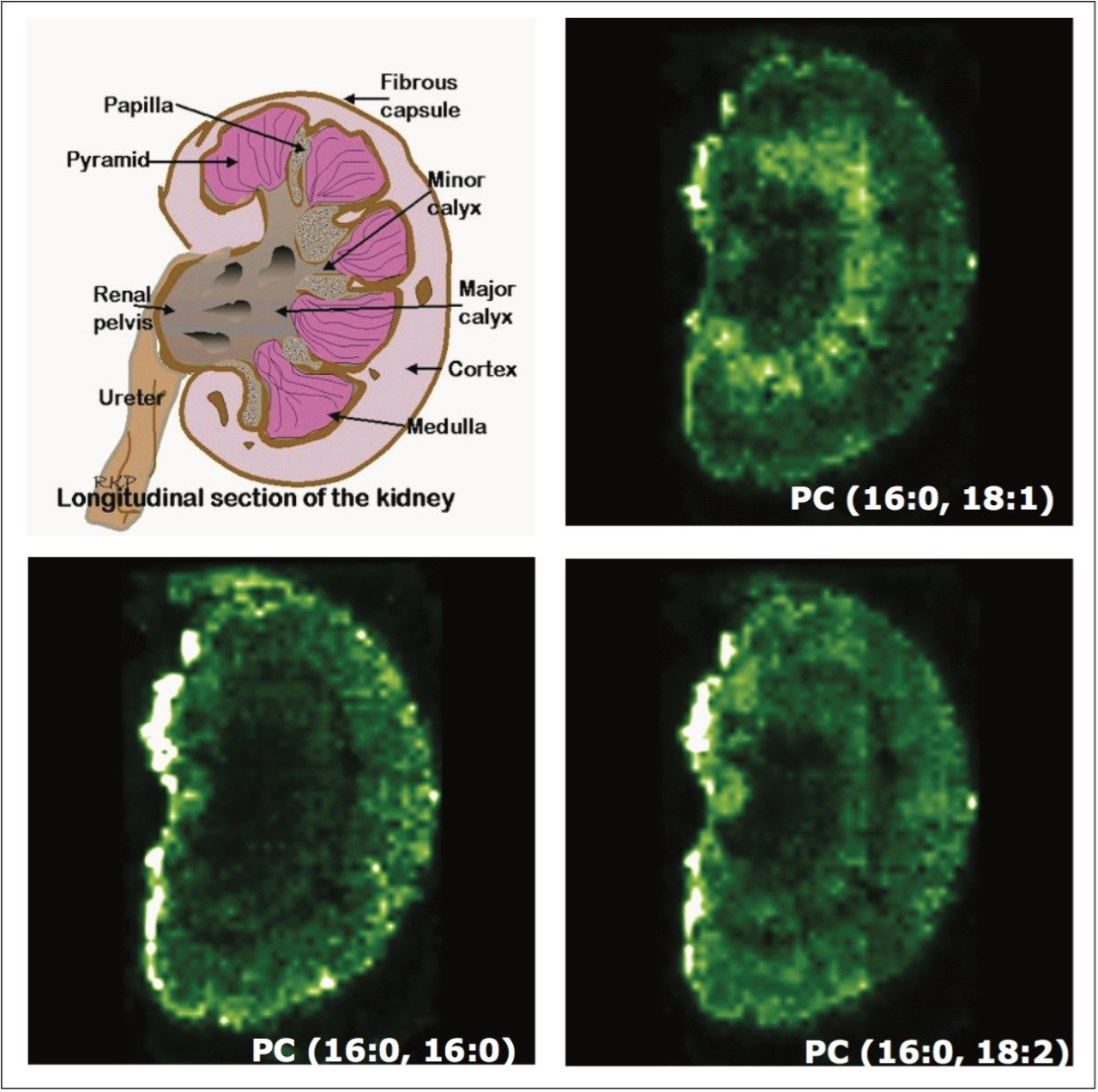 Direct Tissue Imaging and Characterization of Phospholipids Using MALDI ...