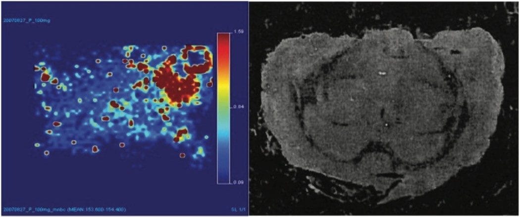 Localizing Diazepam And Its Metabolite In Rat Brain Tissue By Imaging Mass Spectrometry Using