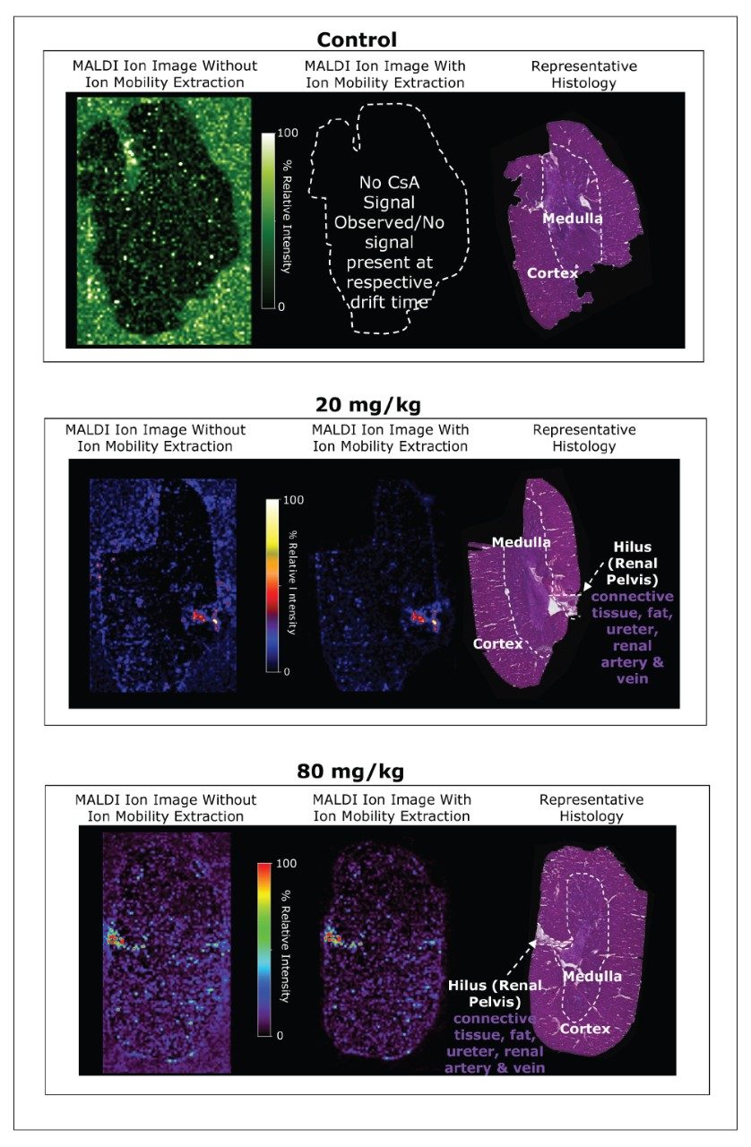 Tissue Imaging of Pharmaceuticals by Ion Mobility Mass Spectrometry ...