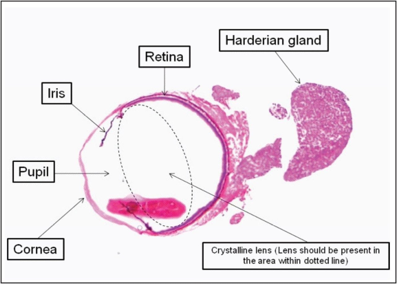 Successful Application for Distribution Imaging of Chloroquine Ocular ...