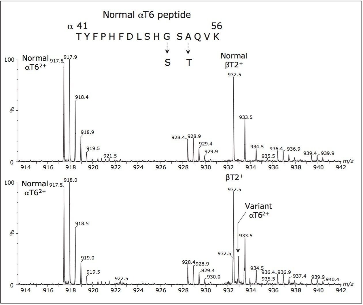 Identification of Human Hemoglobin Protein Variants Using Electrospray ...