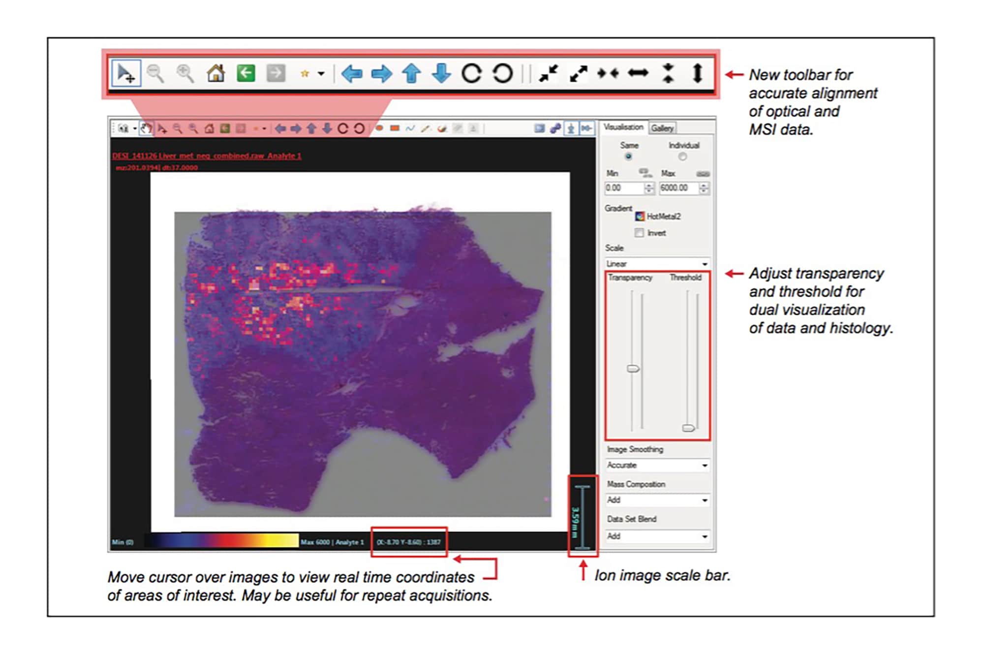 High Definition Imaging Software: Enhanced Visualization and Overlay of ...