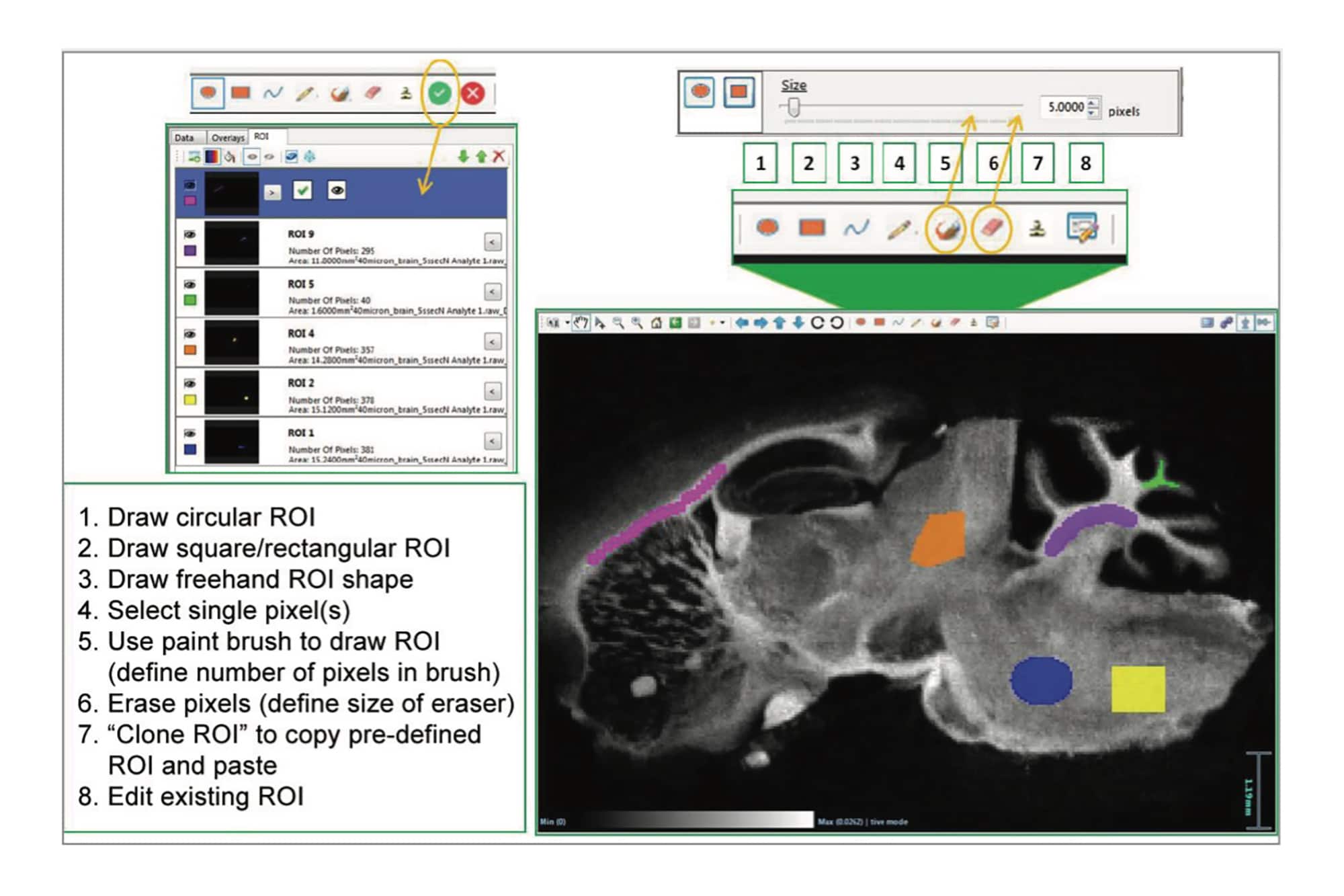 High Definition Imaging (HDI v 1.4): “Region of Interest” Functionality ...