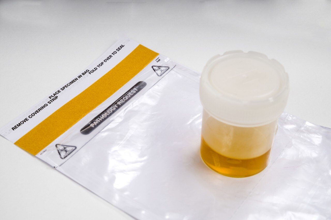 Methadone and Metabolites in Human Urine : Waters